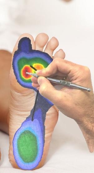 Feet Care Treatment London | Feet Pain | Mr Salus Sporting Lab