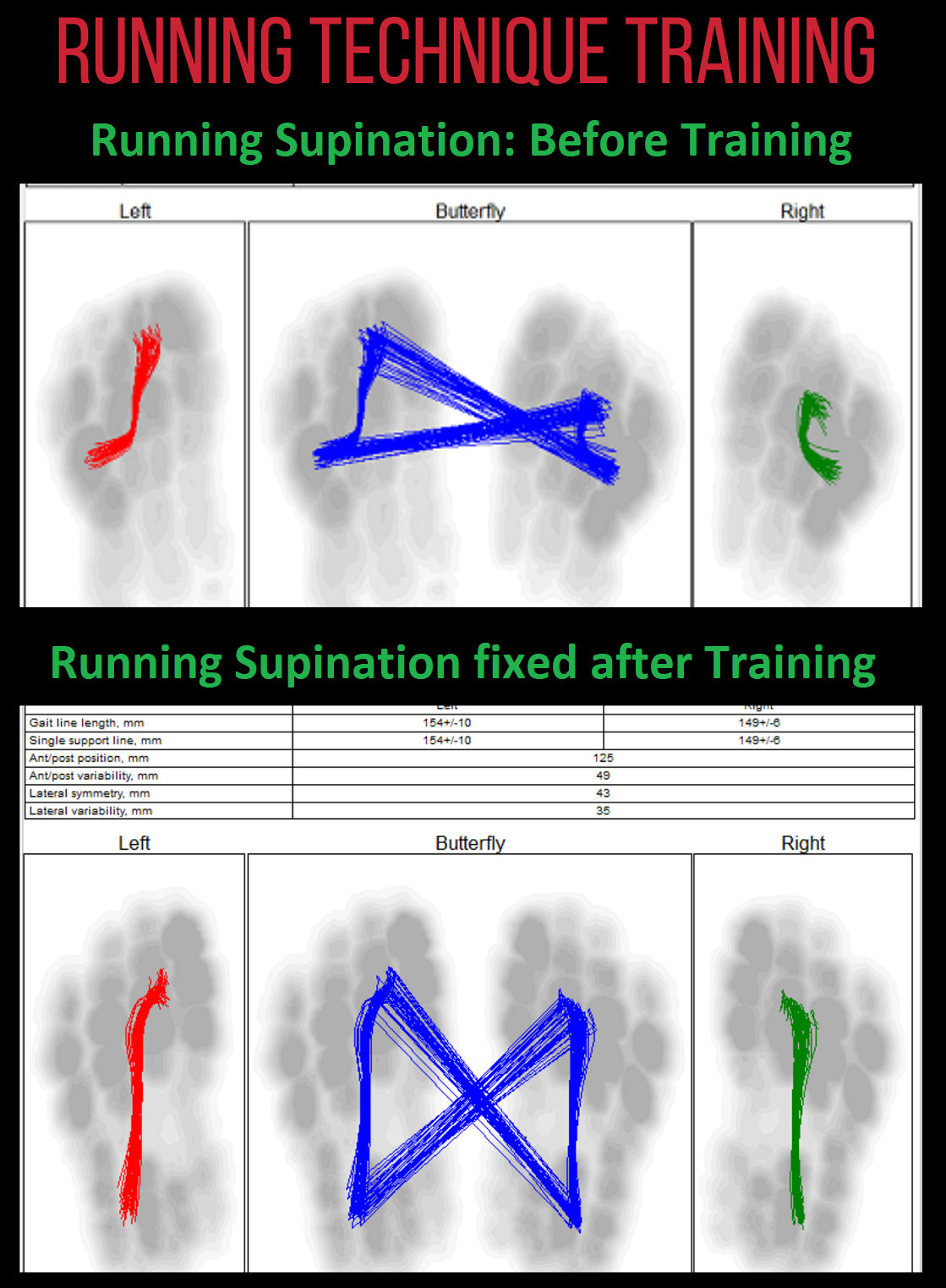 How to fix running supination with neuromuscular running training: a ...